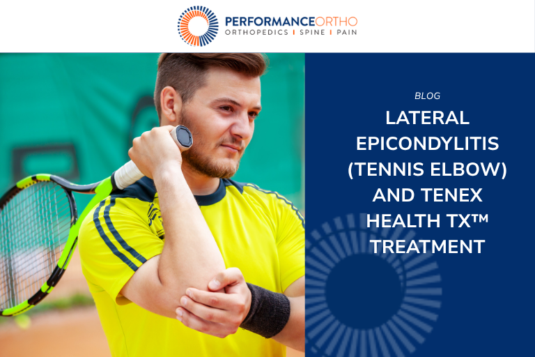 Lateral Epicondylitis (Tennis Elbow) And Tenex Health TX™ Treatment In ...