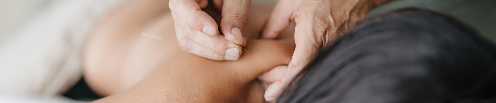 Osteopathy And Acupuncture In NJ | Rehabilitation | Performance Ortho